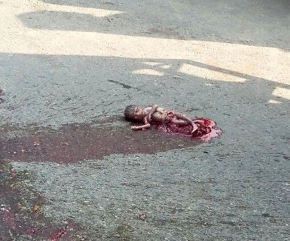 【閲覧注意】妊娠した女性が激しい事故で死亡 ⇒ 少し離れた所に(2枚) ポッカキット