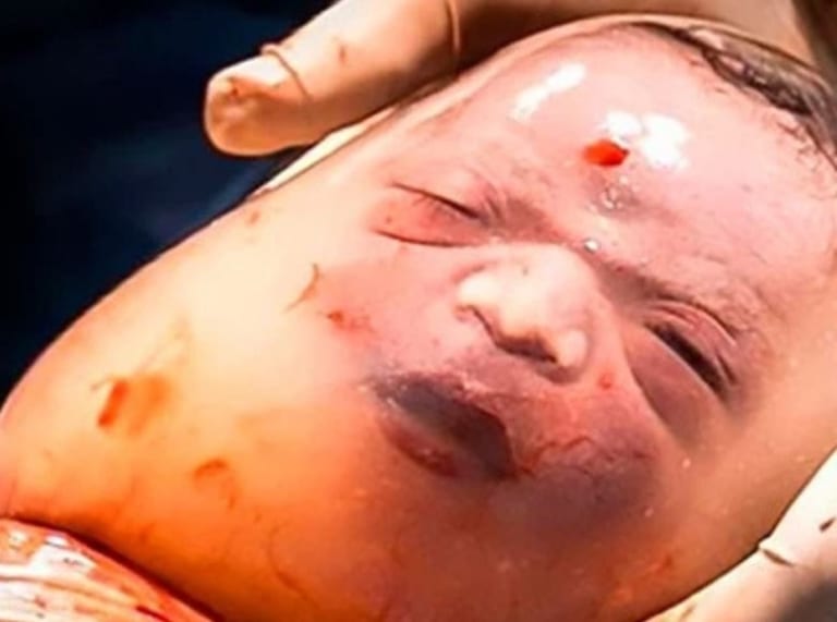 100000人に1人。”羊水の膜に覆われたまま生まれた赤ちゃん” が凄すぎる（画像あり） ポッカキット